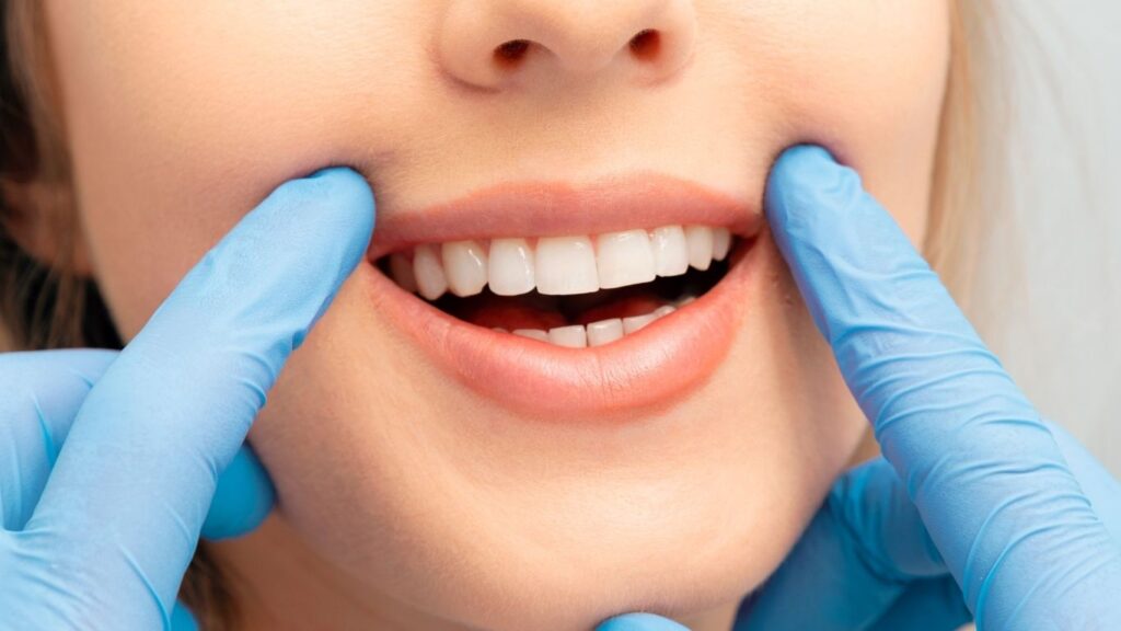 Best Teeth-Whitening Supplements According to Dentists